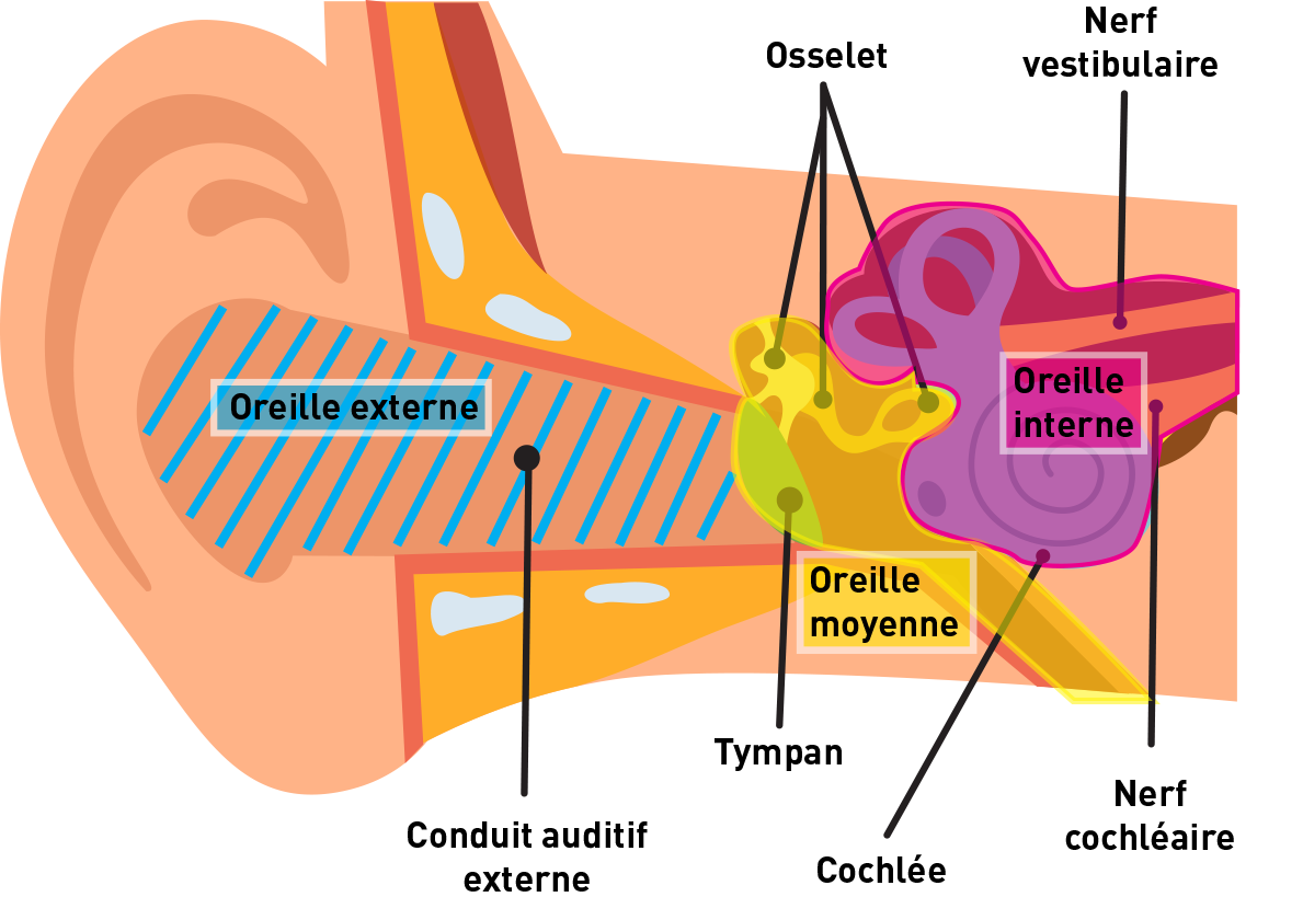Troubles de l'audition - CPR